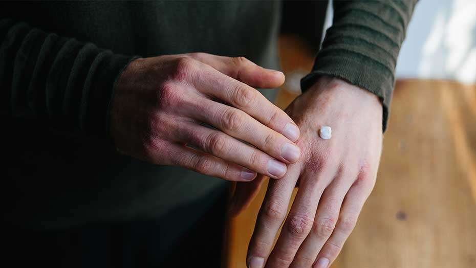 Uncomfortable, Itchy, Dry, Winter Skin? | Patient First